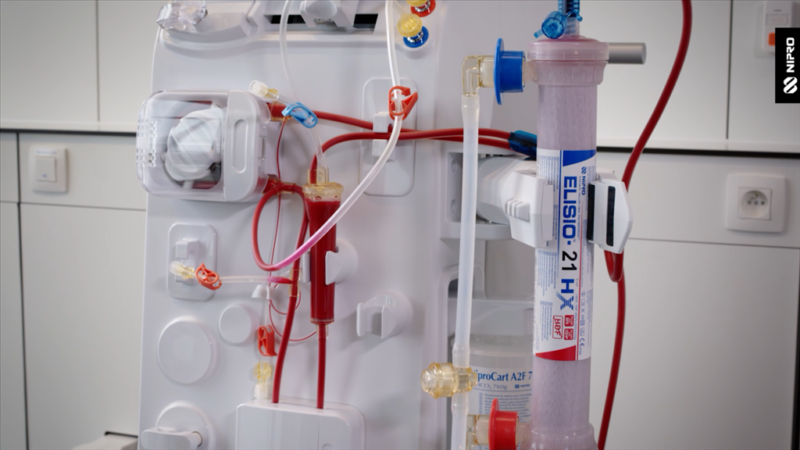 Surdial™ fleX - Hemodialysis Machine for Dialysis Treatments | Nipro ...